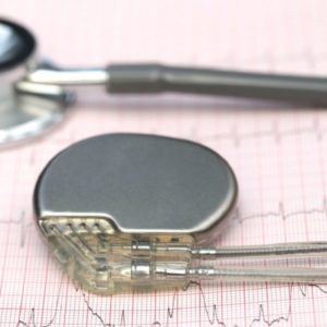 Alat Pacu Jantung (Pacemaker): Fungsi, Jenis, Cara Kerja
