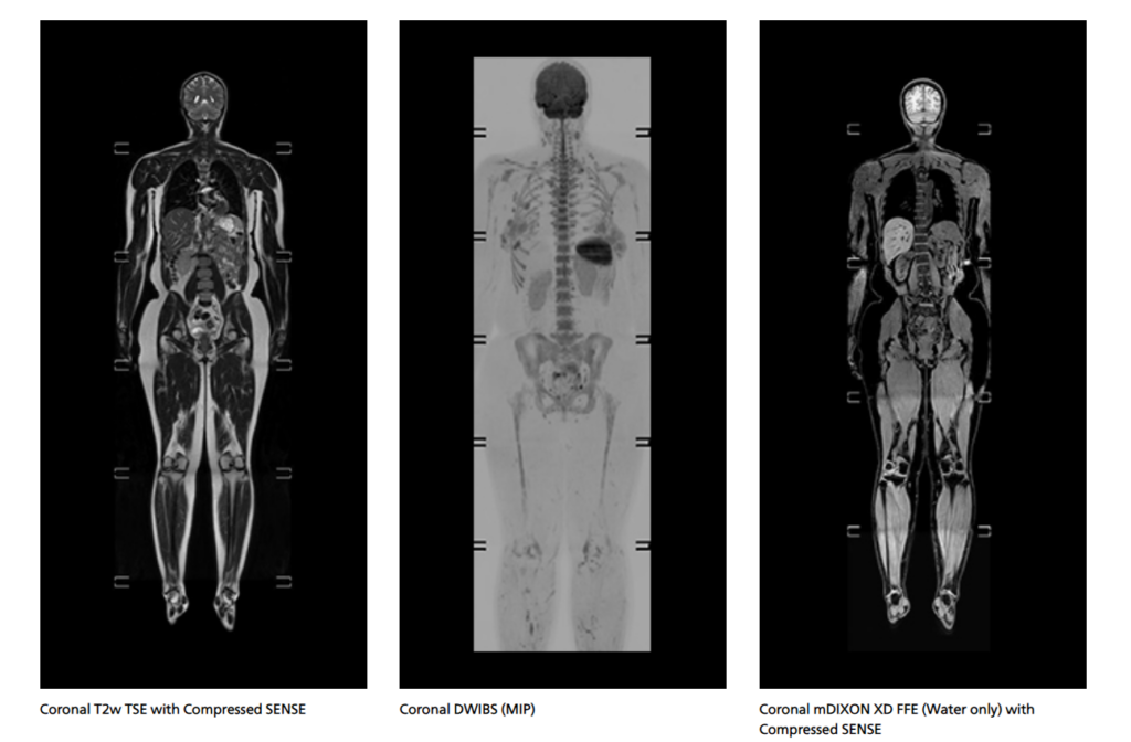Cancer Cases Could Be Prevented
