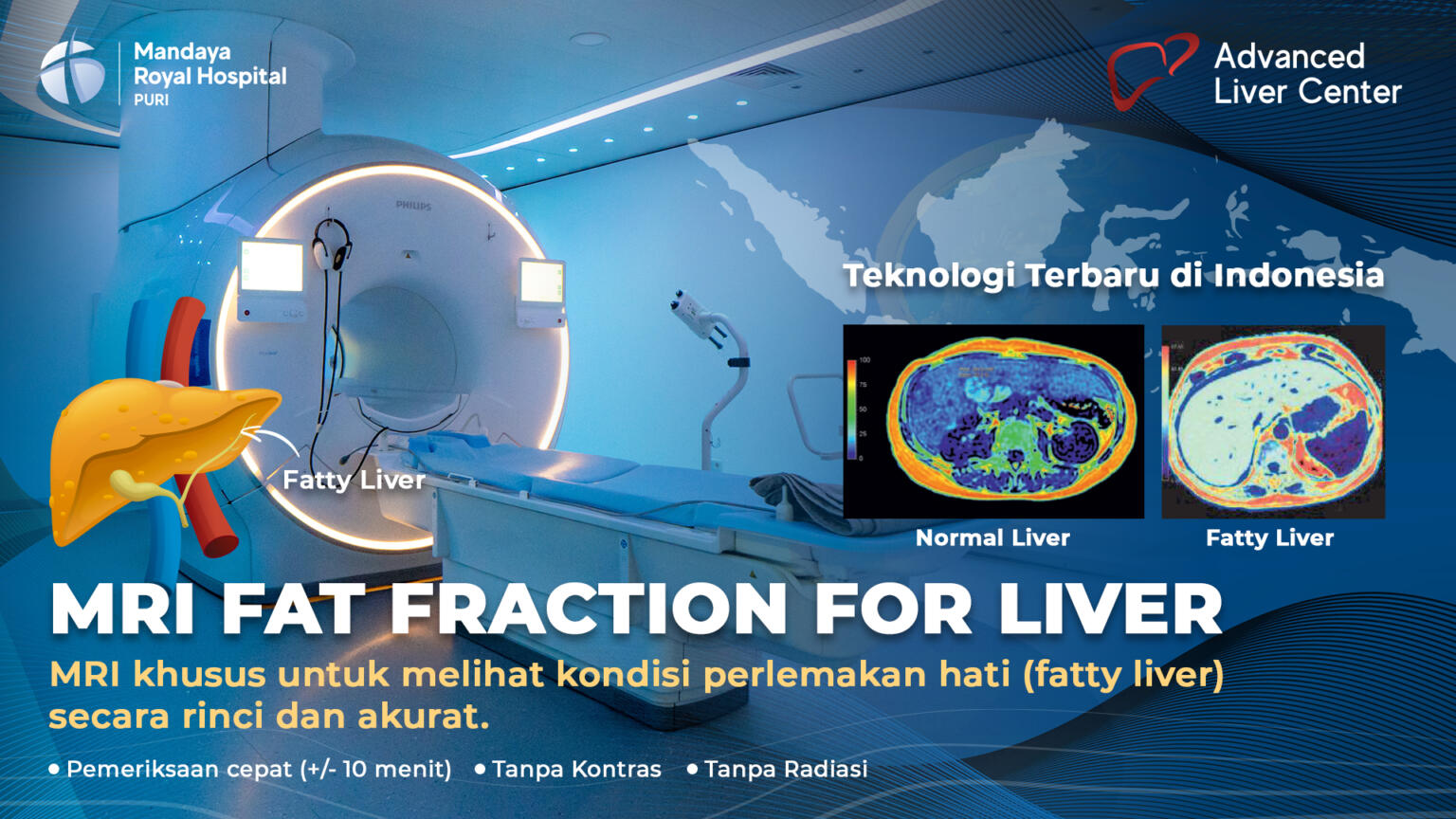 MRI Liver: Fungsi, Prosedur, dan Risiko - Mandaya Hospital Group