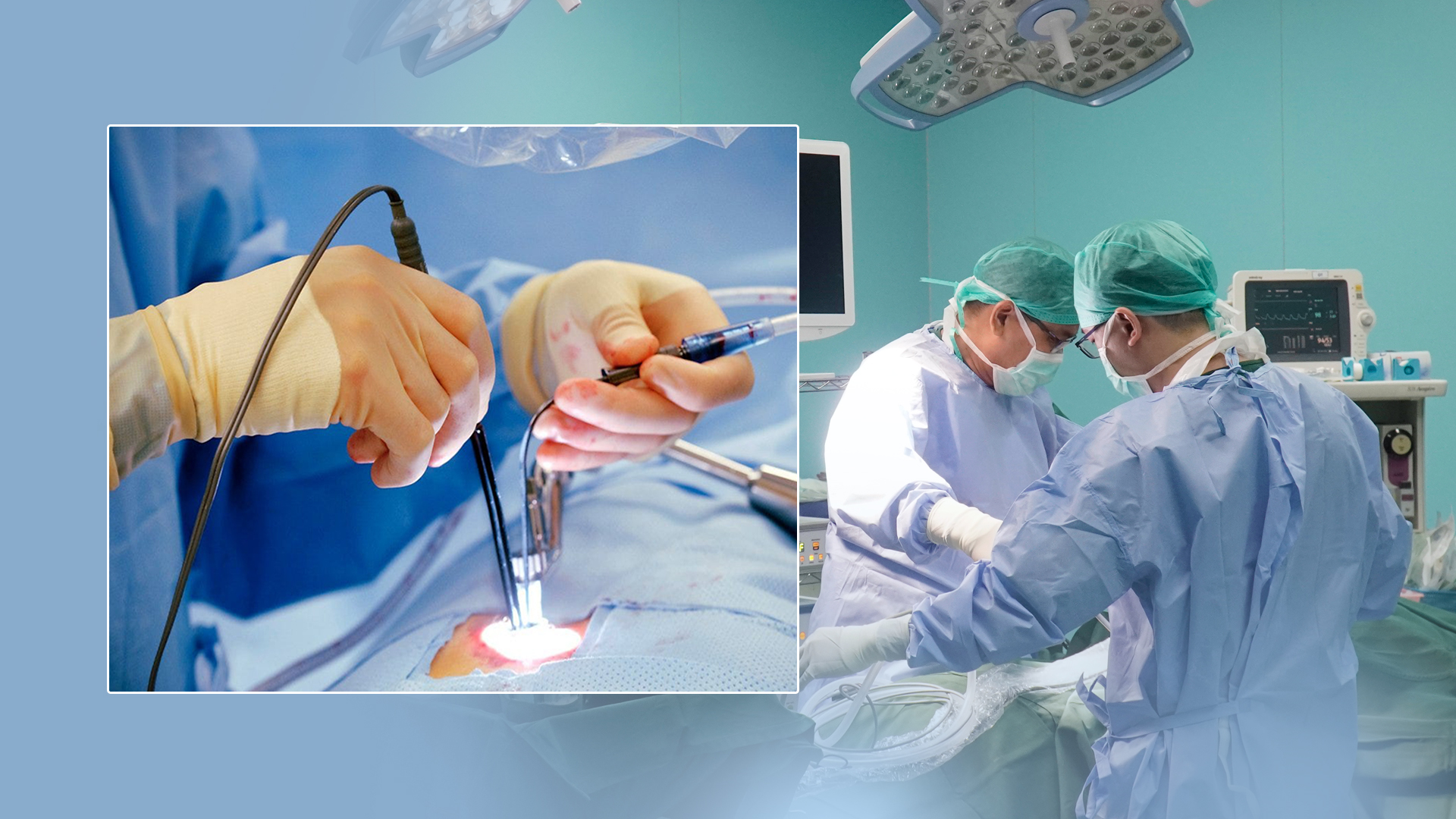 Atasi Wasir Minimal Nyeri Dengan Laser Hemorrhoid - Mandaya Hospital Group