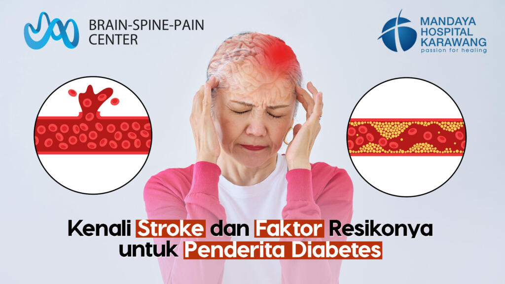 Kenali Stroke dan Faktor Resikonya untuk Penderita Diabetes - Mandaya ...