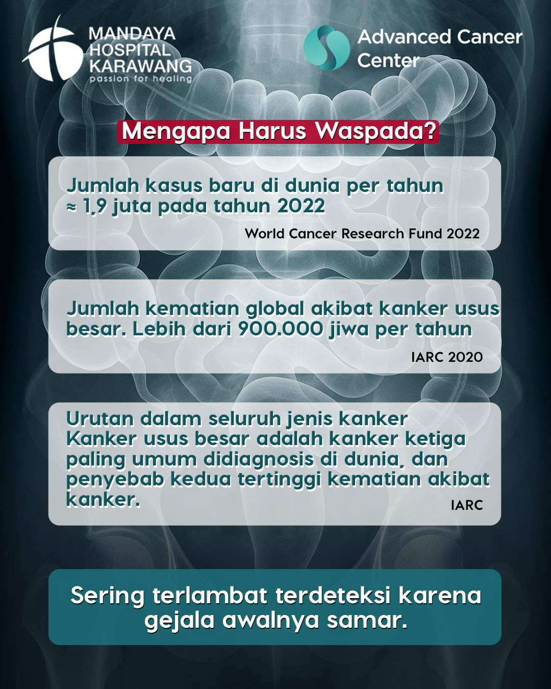 Deteksi Dini Kanker Usus Besar : Kolonoskopi - Mandaya Hospital Group