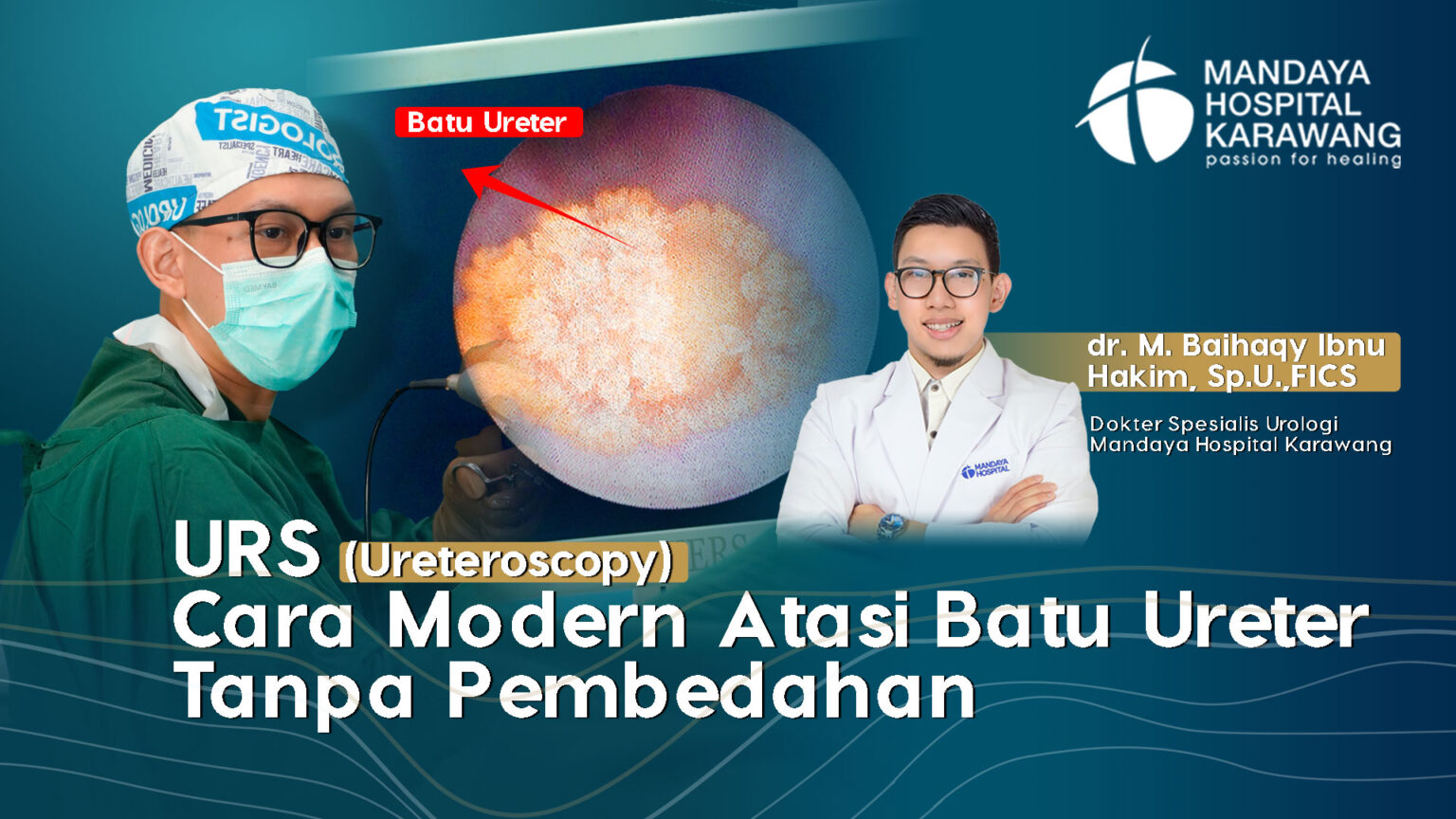 URS (Ureteroscopy) Cara Modern Atasi Batu Ureter Tanpa Pembedahan Di Karawang - Mandaya Hospital ...