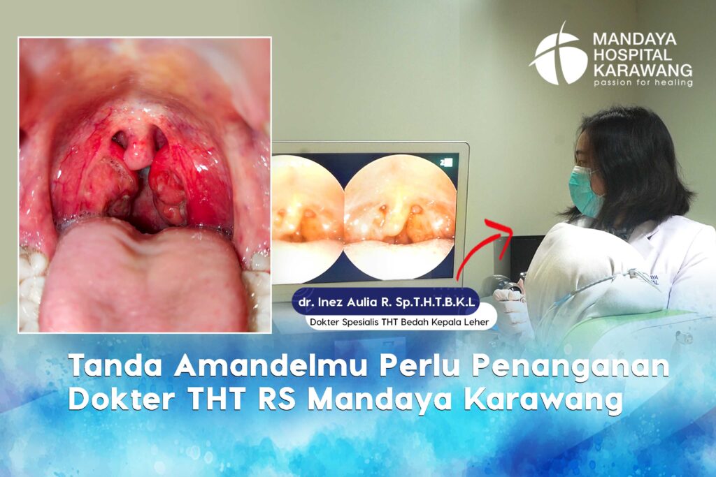 Tanda Amandelmu Perlu Penanganan Dokter THT RS Mandaya Karawang ...