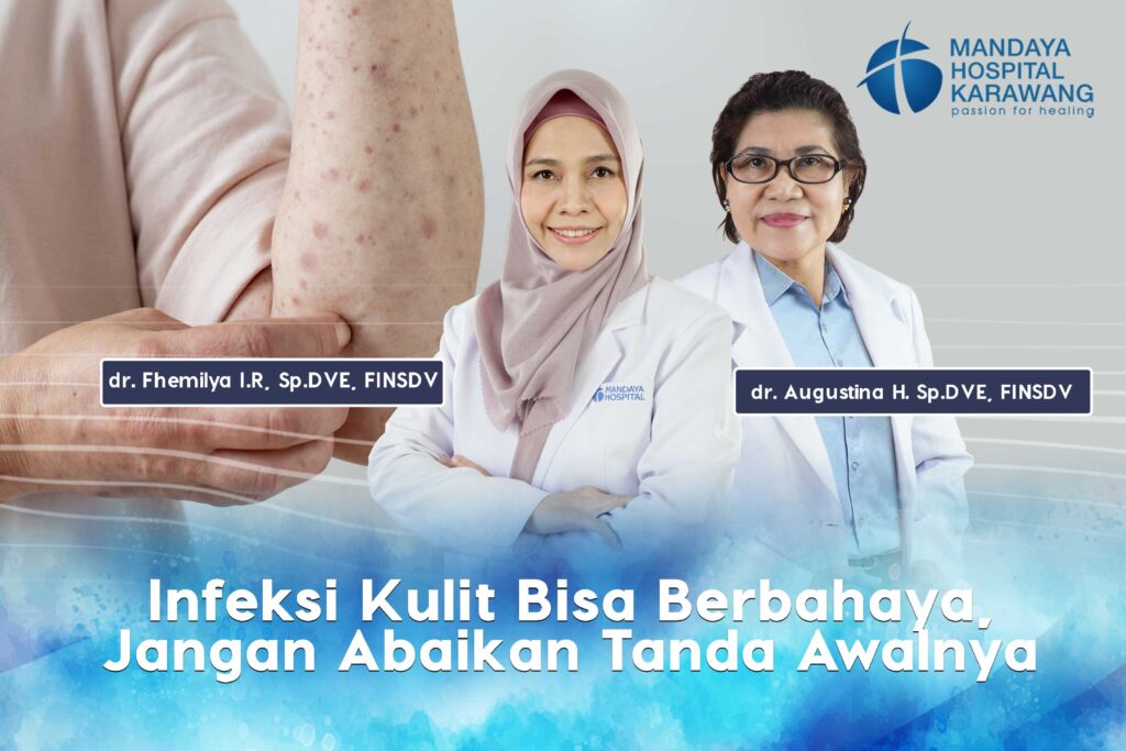 Infeksi Kulit Bisa Berbahaya, Jangan Abaikan Tanda Awalnya - Mandaya Hospital Group